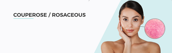Couperose / Rosaceous | SkinGen™