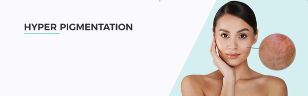 Hyper Pigmentation | SkinGen™